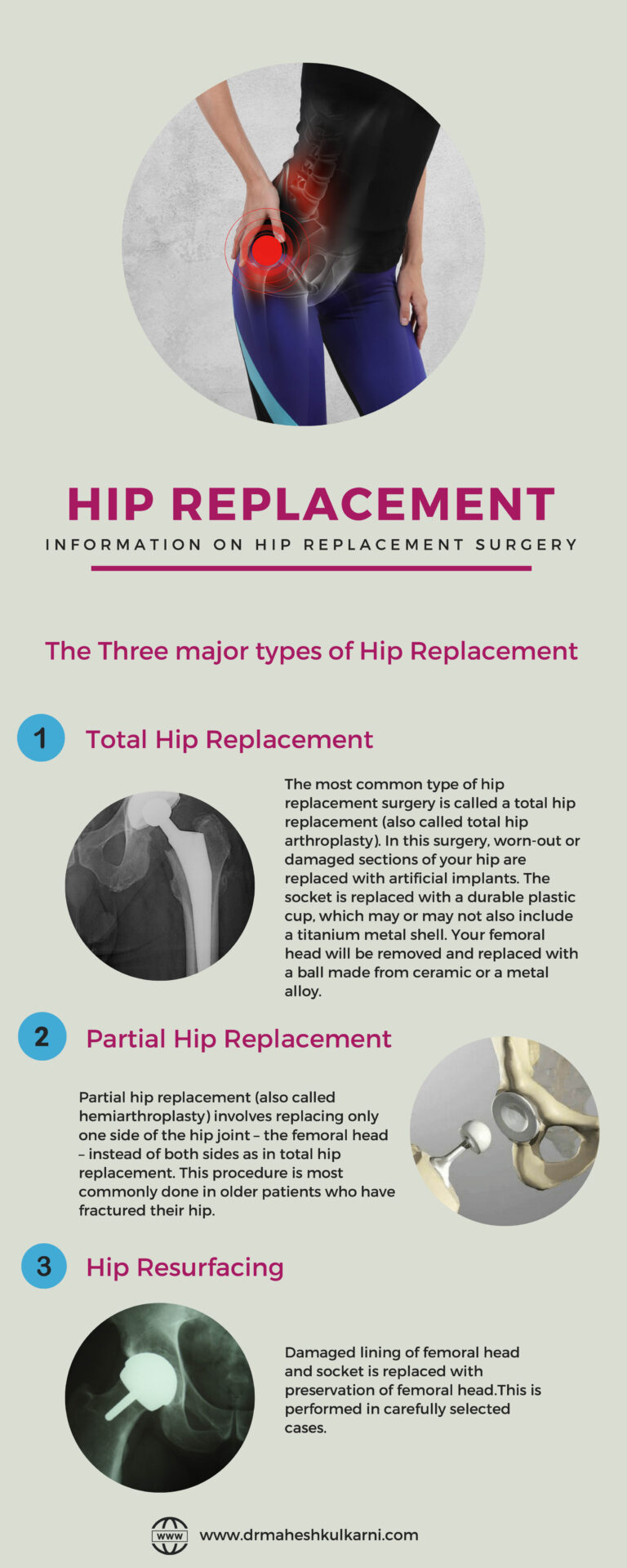 Things you should know about Hip replacement Surgery | Dr. Mahesh Kulkarni